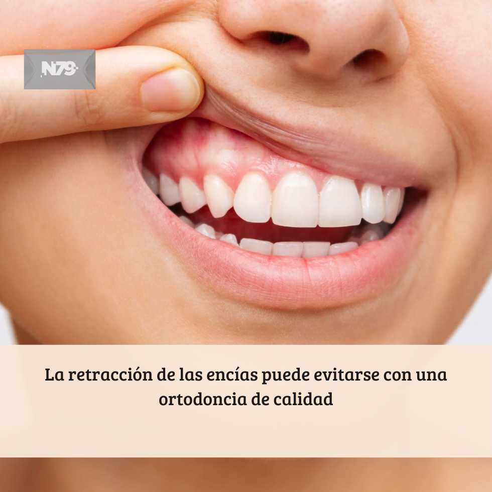 La retracción de las encías puede evitarse con una ortodoncia de calidad