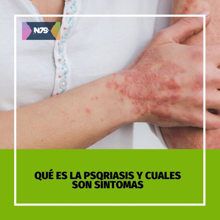 Qué es la psoriasis y cuales son síntomas